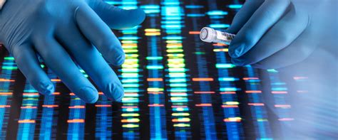 A Comprehensive Guide To Understanding Medical Tests For Diagnosing Cvs