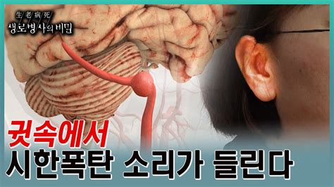 내 귀에서 심장 박동소리와 똑같은 간격으로 소리가 들린다면 마치 귓속에 시한폭탄이 들어 있는 것 같은 박동성 이명의 증상과
