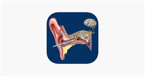‎ear Disorders Outer Middle On The App Store