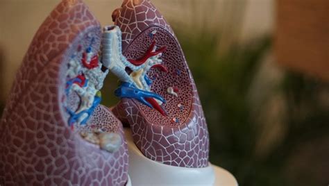 Tumore Al Polmone Limmunoterapia Migliora La Sopravvivenza A Lungo
