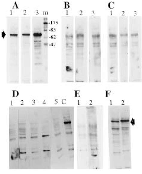 Western Blot Analysis Of Cellular Protein Extracts From Breast Cancer