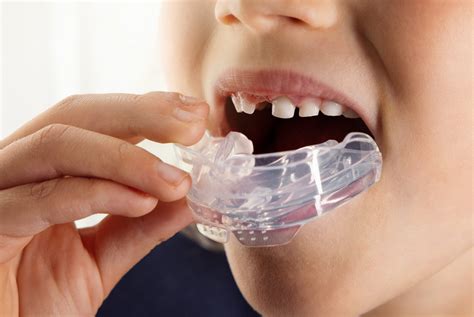 Myobrace | Liverpool dental care
