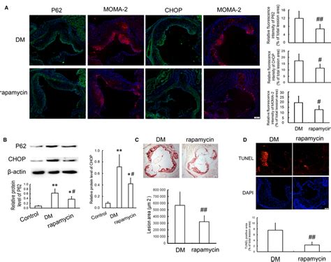 Effects Of Rapamycin On Chop Expression And Apoptosis In Download
