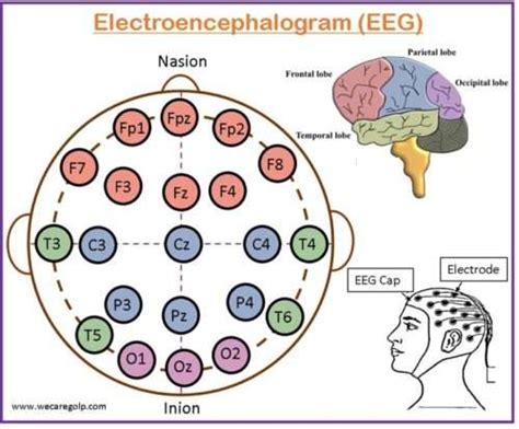 Eeg Electroencephalogram Purpose Procedure And Risks😉 Descubra Se