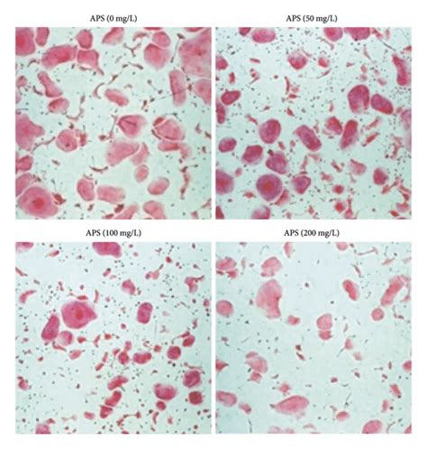 Aps Inhibited Rankl Induced Ocs Differentiation And Gene Expression