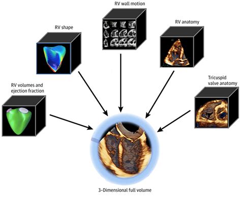 New Directions In Right Ventricular Assessment Using 3 Dimensional