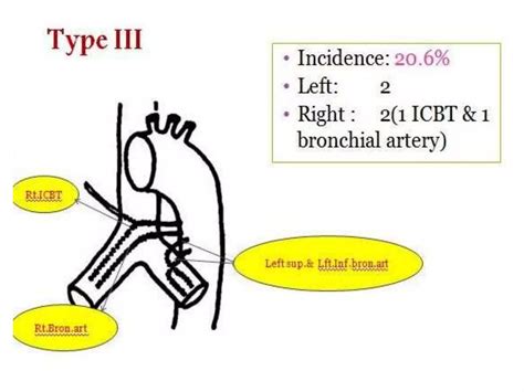 Bronchial Artery Embolization By Drtinku Joseph Pptx