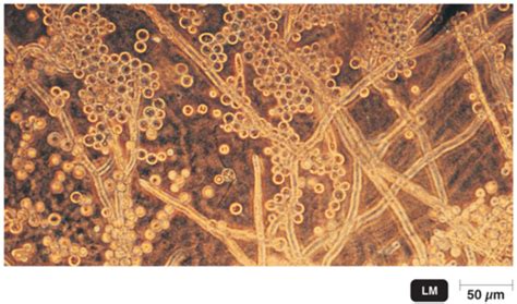 Fungi And Genital Infection Flashcards Quizlet