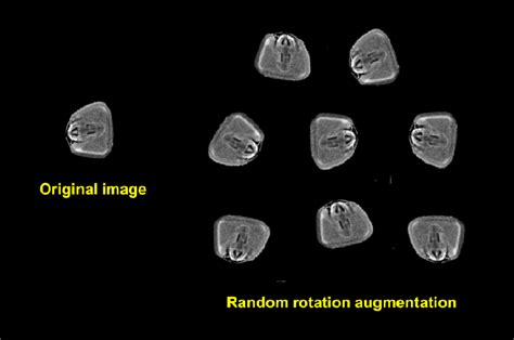 data augmentation method based on random rotations and flips mirror