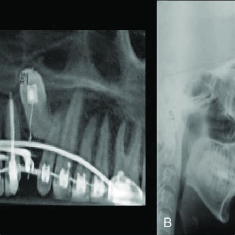 Preoperative Routine Radiographic Investigations A Opg B Lateral