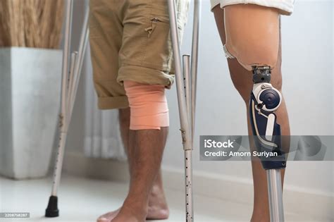 무릎에 붕대를 감은 사람과 집에서 목발을 짚고 함께 서 있는 의족을 가진 사람 2명에 대한 스톡 사진 및 기타 이미지 2명 35 39세 40 44세 Istock