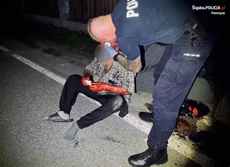 Policjanci z Pszczyny udzielili pierwszej pomocy mieszkańcowi Kobióra