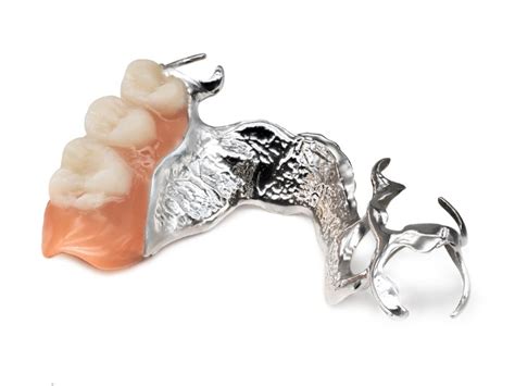 Cast Framework Yen Dental