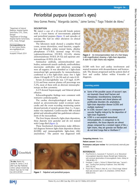 Pdf Periorbital Purpura Raccoons Eyes