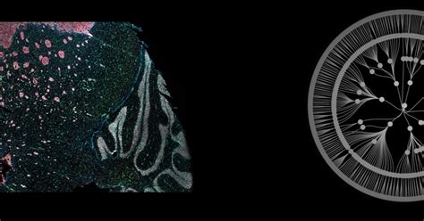 Tumor Progression And Metastasis University Of Helsinki