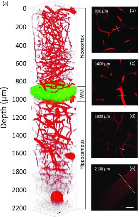 the 3pm image of the deep brain vasculature in adult mouse in vivo download scientific