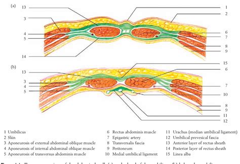 Figure 241 From Atlas Of Operative Laparoscopy And Hysteroscopy