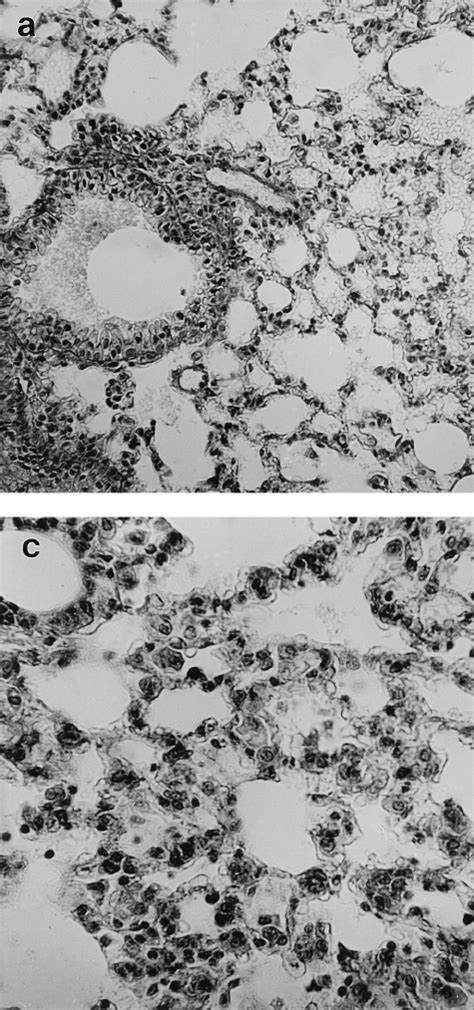 Histological Evolution Of Experimental A Baumannii Pneumonia In Mice