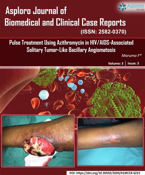 Pulse Treatment Using Azithromycin In Hiv Aids Associated Solitary Tumor Like Bacillary