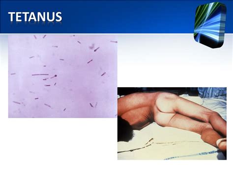 Ppt Microbiology Powerpoint Presentation Free Download Id 2000440