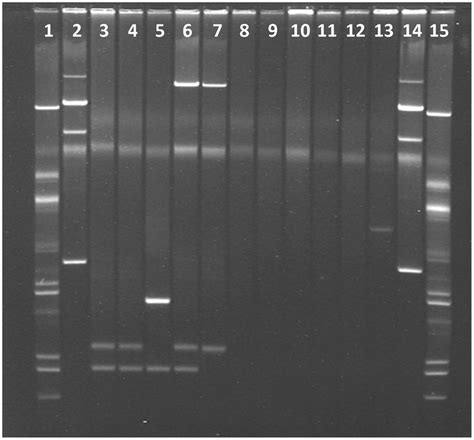 Plasmid Profiles Of 11 Salmonella Isolates Belonging To Four Different