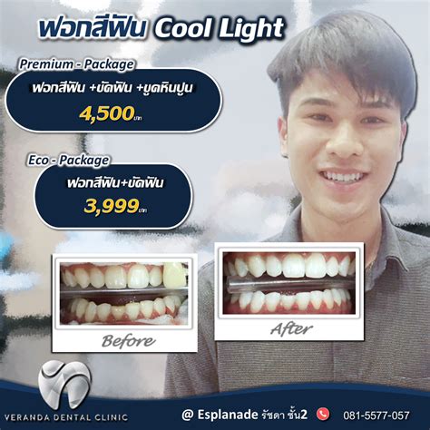 ราคา ฟอก สี ฟัน 16 อันดับแรก