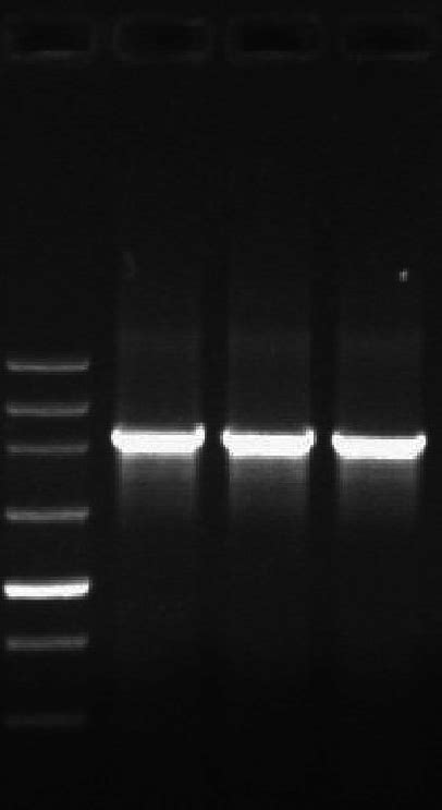 colony pcr confirmation of e coli clones carrying the pmd19 t psox6 download scientific