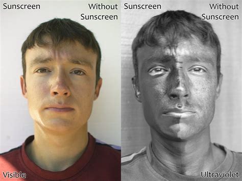 Uv Photo With And Without Sunscreen Skincareaddiction