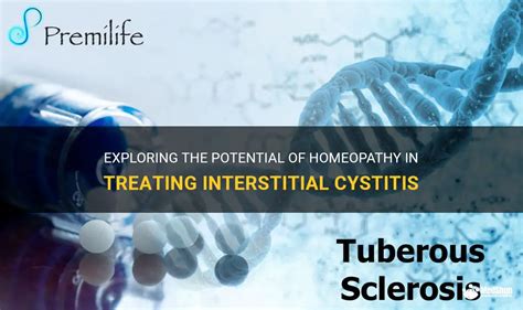 Exploring The Potential Of Homeopathy In Treating Interstitial Cystitis Medshun