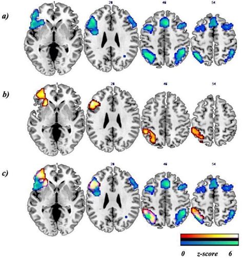 Main Effects Of The FMRI RE Task Note Results Of A Whole Brain