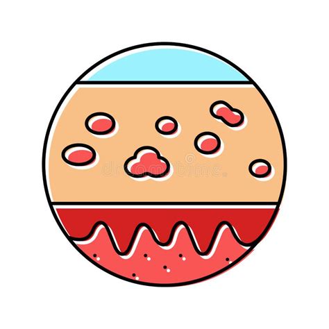 Skin Rashes Icon Stock Illustrations 84 Skin Rashes Icon Stock