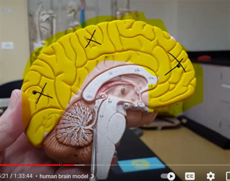 Csn Lab 7 Biology 223 Part 1 Human Brain Flashcards Quizlet