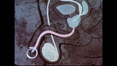 57 Bacteria Spread Stock Videos Editorial Videos And Stock Footage Shutterstock