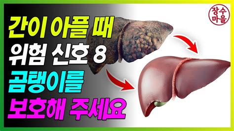 침묵의 장기 간이 위험할 때 나타나는 대표 증상들과 간을 보호하는 방법 Youtube