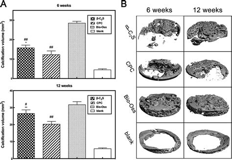 Bone Regeneration In Rabbit Skull Defects After Implantation A Download Scientific Diagram