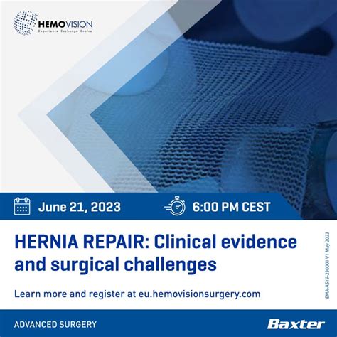 Silvia Prandi Posted On Linkedin