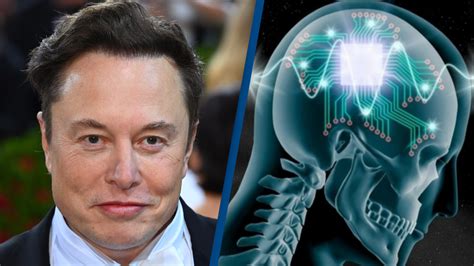 Elon Musks Brain Chip Neuralink N1 A Step Closer To Human Implantation