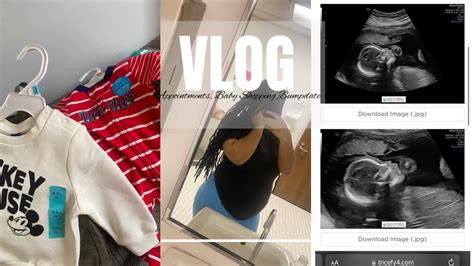 Weekly Vlog 22 Weeks Pregnant Anatomy Scan Being A Mom For 24