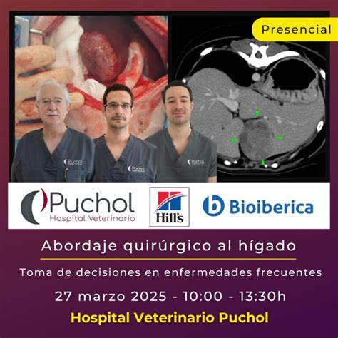 Abordaje Quirúrgico Al Hígado Formación