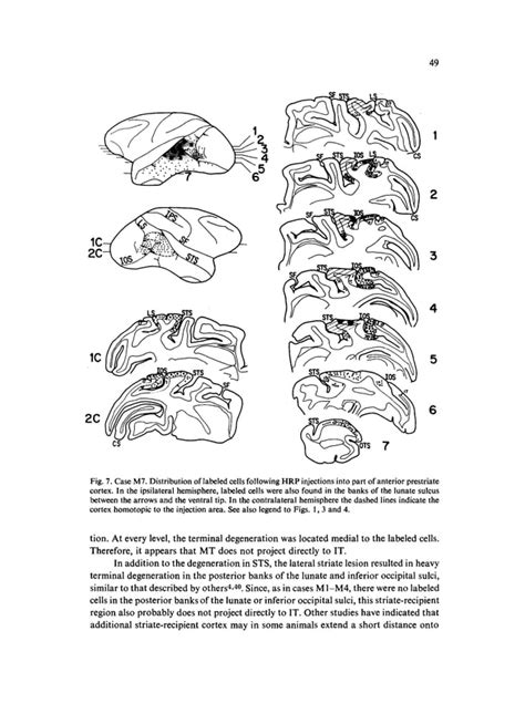 Inferior Temporal Cortex Pdf