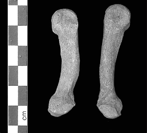 Right 5th Metacarpal On The Left In The Photo Of The Hand Showing Download Scientific Diagram Right 5th Metacarpal On The Left In The Photo Of The Hand Showing Download Scientific Diagram