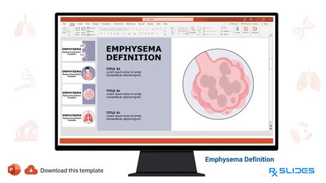 Emphysema Ppt