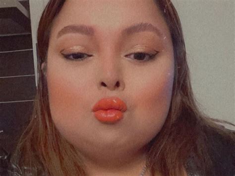 Is Shawty Bae Disabled Disability And Health 2024