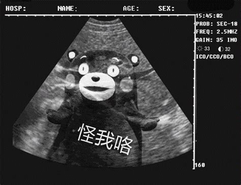 我怀孕了套路表情包搞笑B超图 微信