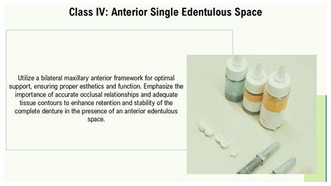 Denture Kennedy Classification Ppt Summary Acp