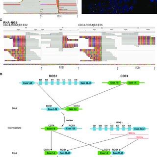 PDF Case Report A Novel Reciprocal ROS1 CD74 Fusion In A NSCLC