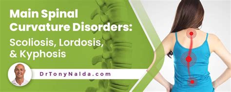 Main Spinal Curvature Disorders Scoliosis Lordosis And Kyphosis