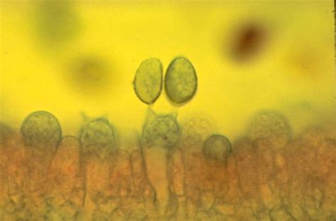 Basidia Microscope
