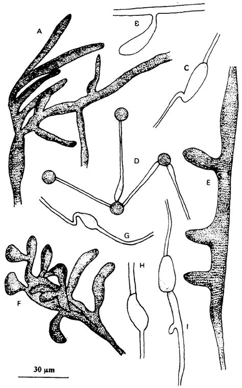 Non Identified Isolates Of Pythium A Dendroid Sporangium B D