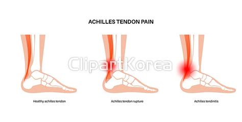 해외작가포토 클립아트코리아 통로이미지주